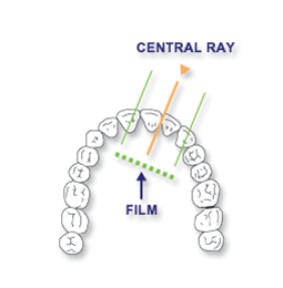 Dentistry and Medicine: Intraoral Radiographic Techniques (The ...