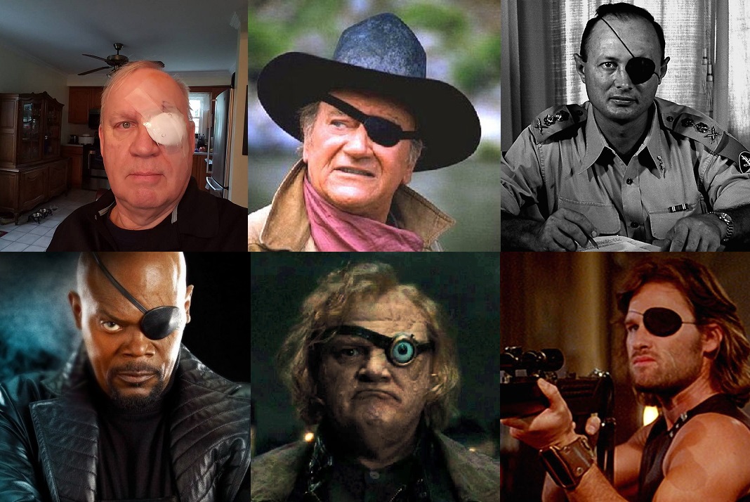 Chant du Départ: Patches? We Don't Need No Stinking Patches!