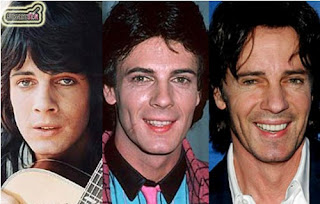 Rick Springfield Plastic Surgery Blog: Rick Springfield Plastic Surgery ...