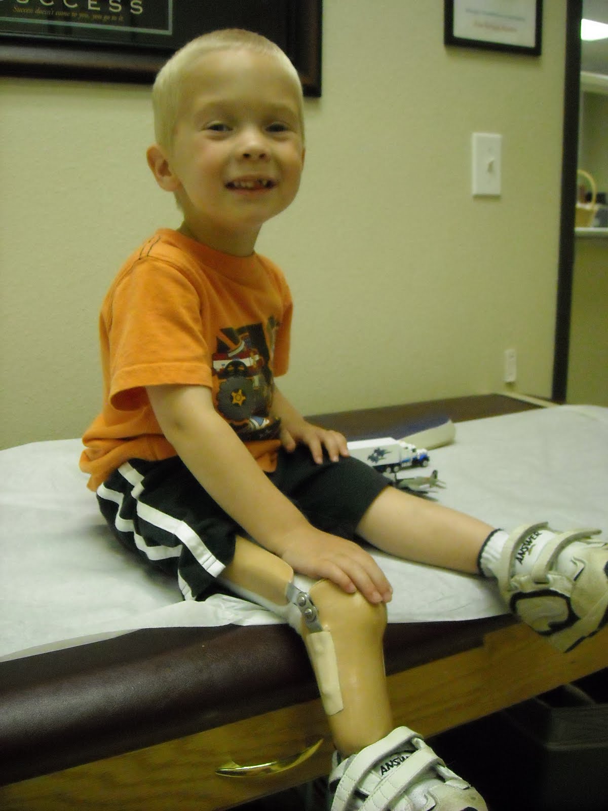 Mason's Progress with PFFD: 3rd Edition Prosthesis