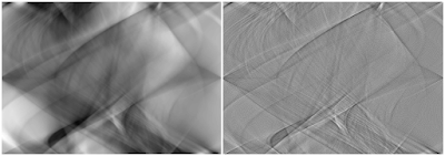 crazybiocomputing: Learning Tomography: Weighted Back-Projection