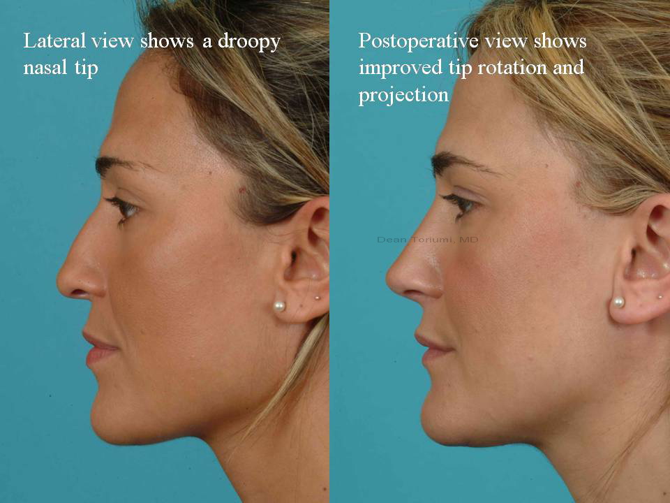 Dr. Dean Toriumi Reviews: Dean Toriumi Reviews: Patient that presents ...