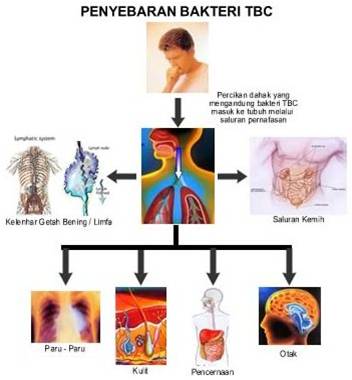 Jemari Inspirasimu: Infeksi TBC