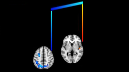 Helge Scherlund's eLearning News: The brain and music: McGill team ...