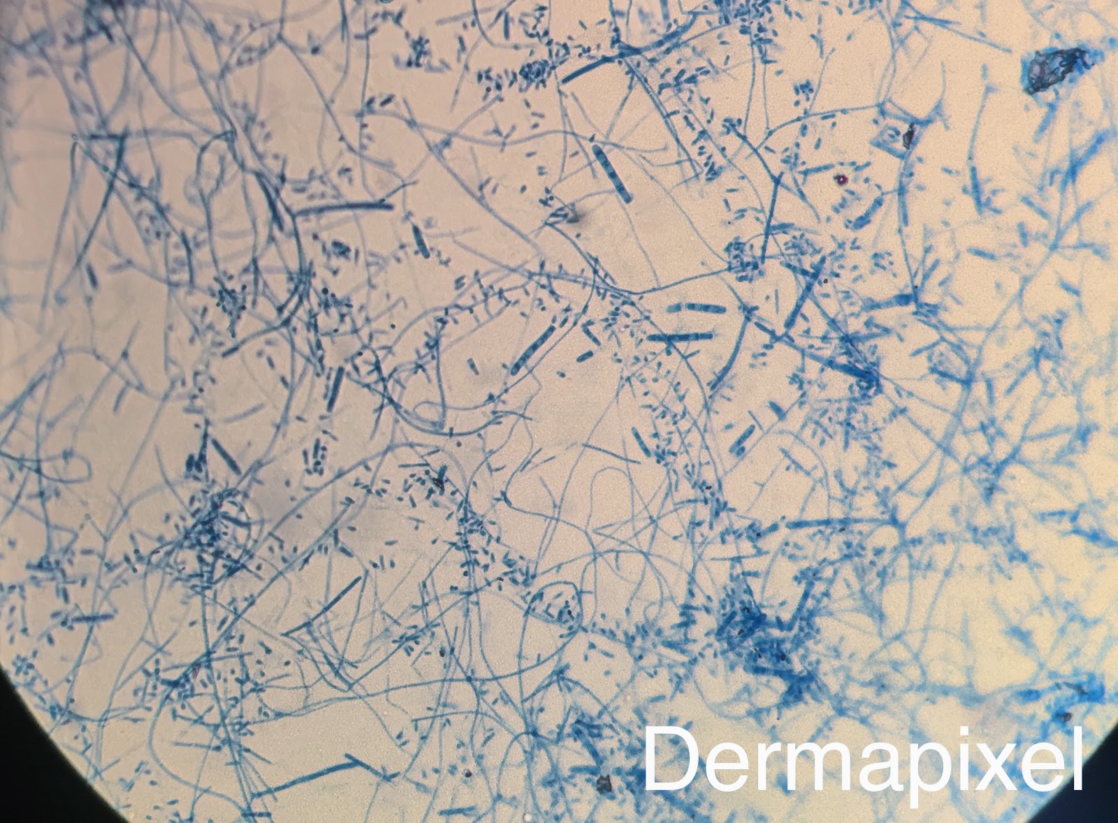 Dermapixel: junio 2018