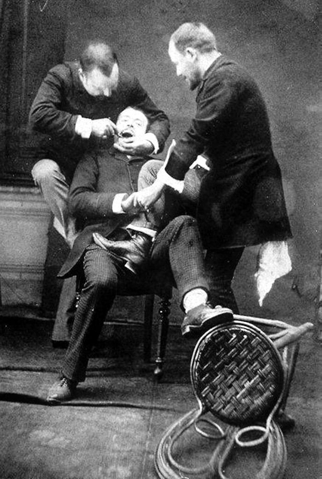 When Tooth Extraction Is Terrifying: 32 Scary Photos Show the Early ...