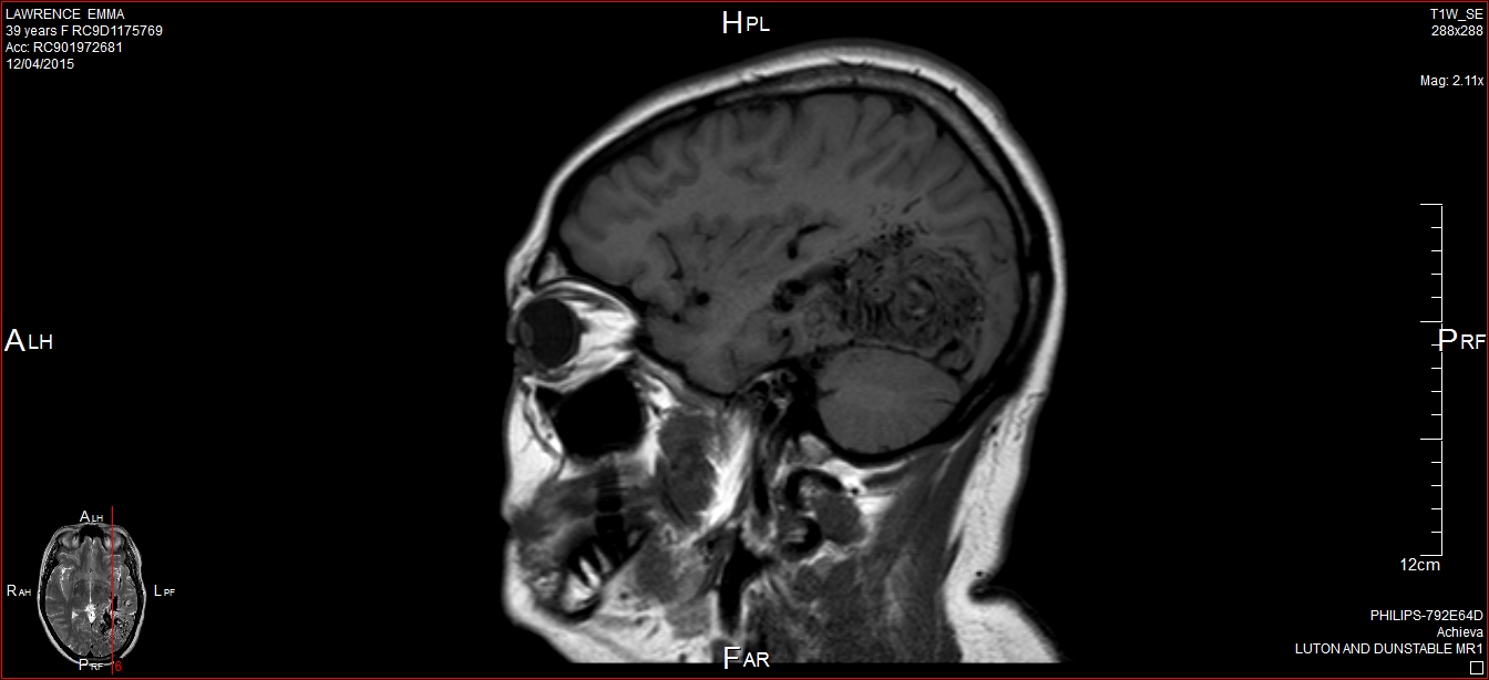 What’s wrong with you now…..spaghetti brain?