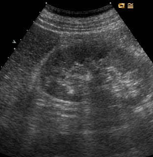 RiT radiology: March 2013