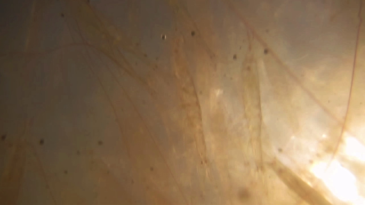 Queensland Coast: Swarming of Asian Paste Shrimps (Acetes sp.)