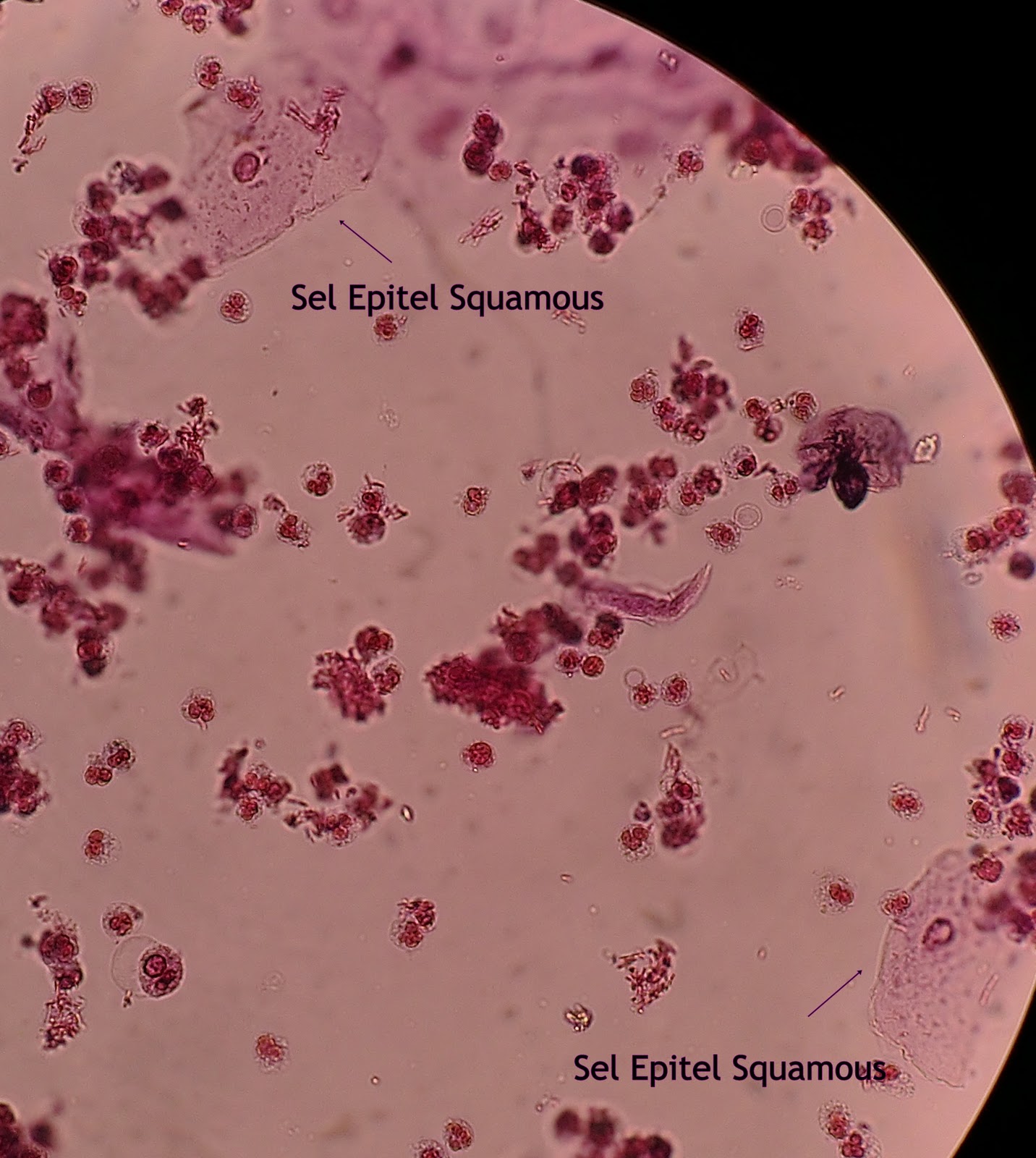 Sedimen Urine Metode Pewarnaan (Stainning) | Analis Kesehatan