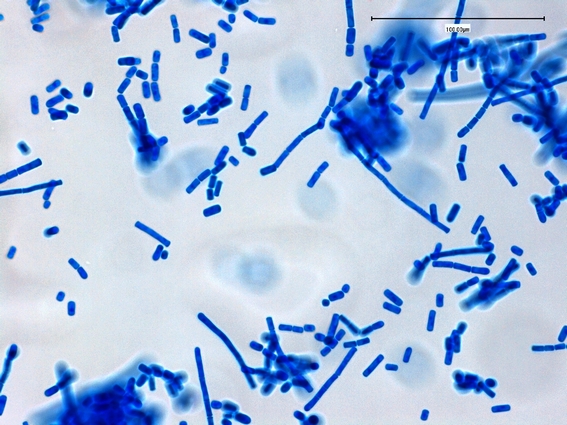 Fun With Microbiology (What's Buggin' You?): Geotrichum candidum