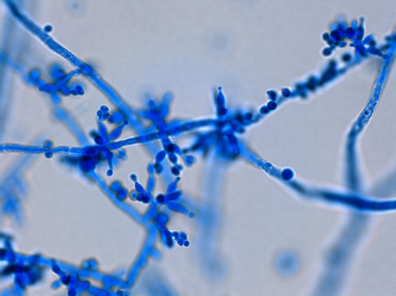 Fun With Microbiology (What's Buggin' You?): Trichoderma species