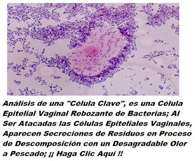 MEDICINA NATURAL REMEDIOS CASEROS: TRATAMIENTO DE VAGINOSIS BACTERIANA