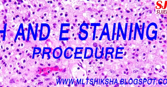 mltshiksha.blogspot.com: H and E Staining Procedure (Hematoxylin and ...