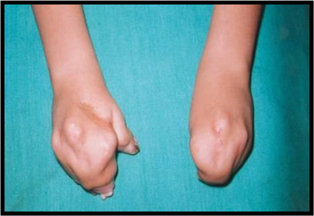 Parahumans: Human-Animal Chimeras?