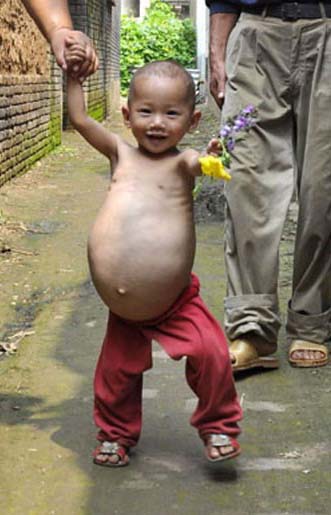 The Loung: See Just One Year Baby Pregnant from 9 Months Gives Birth ...