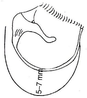 MBBS DOCTORS: OTOSCLEROSIS