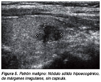 RADIOLOGIA.NORTE.PERU: CLASIFICACION TI RADS