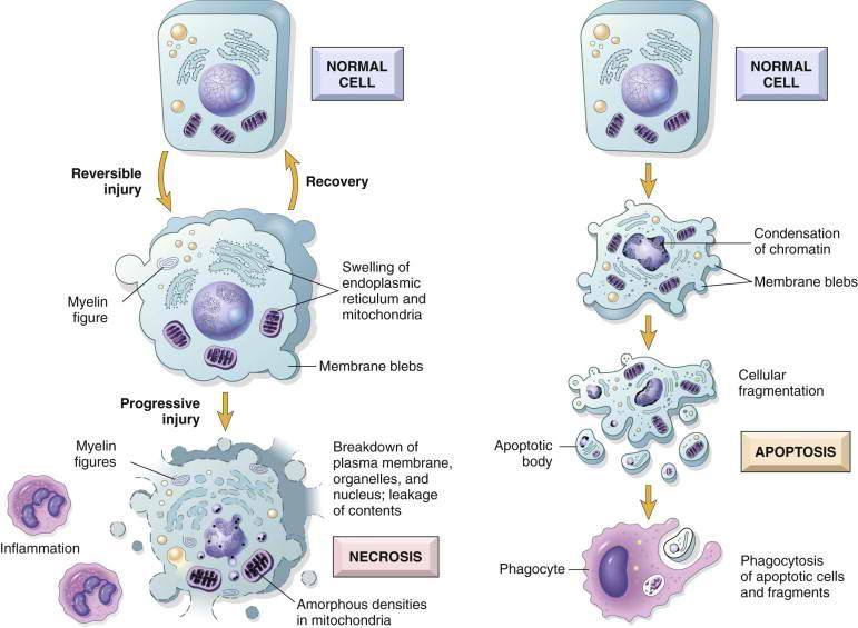 Necrosis Sel: Sel Cacat Yang Tak Mati-Mati Dan Menyusahkan - Amizah Azid