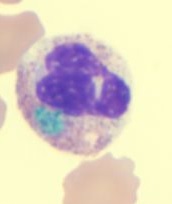 A Dull Day At Work...?: 23 July 2016 (Saturday) - Green Neutrophil ...