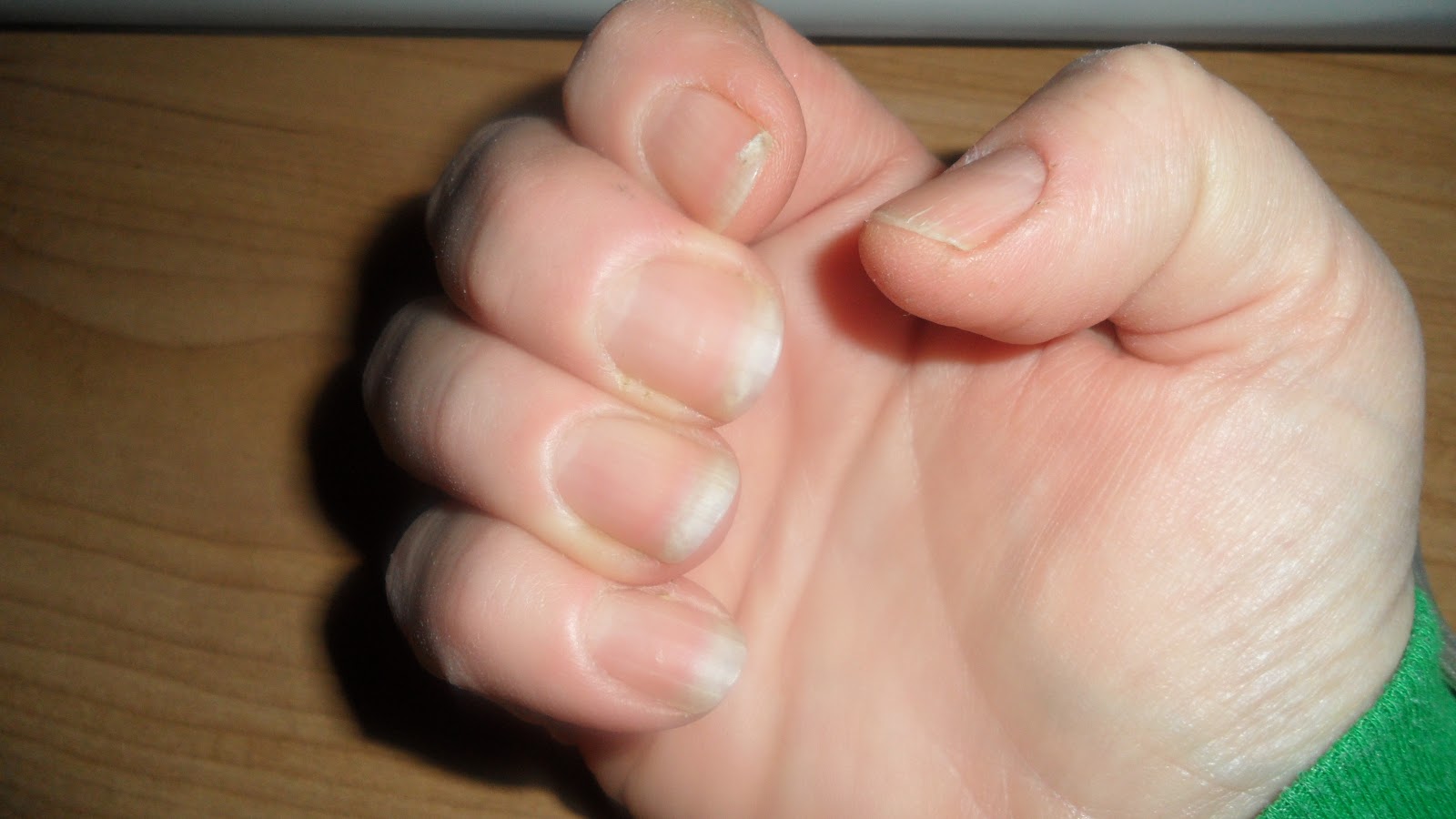 Beauty Blog by Lisa - TIPS from head to toe!: From acrylic damaged ...