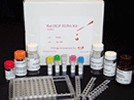 Elisa kits,Reagent Product: What is Melatonin ELISA Kit?