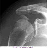 Un médecin du sport vous informe