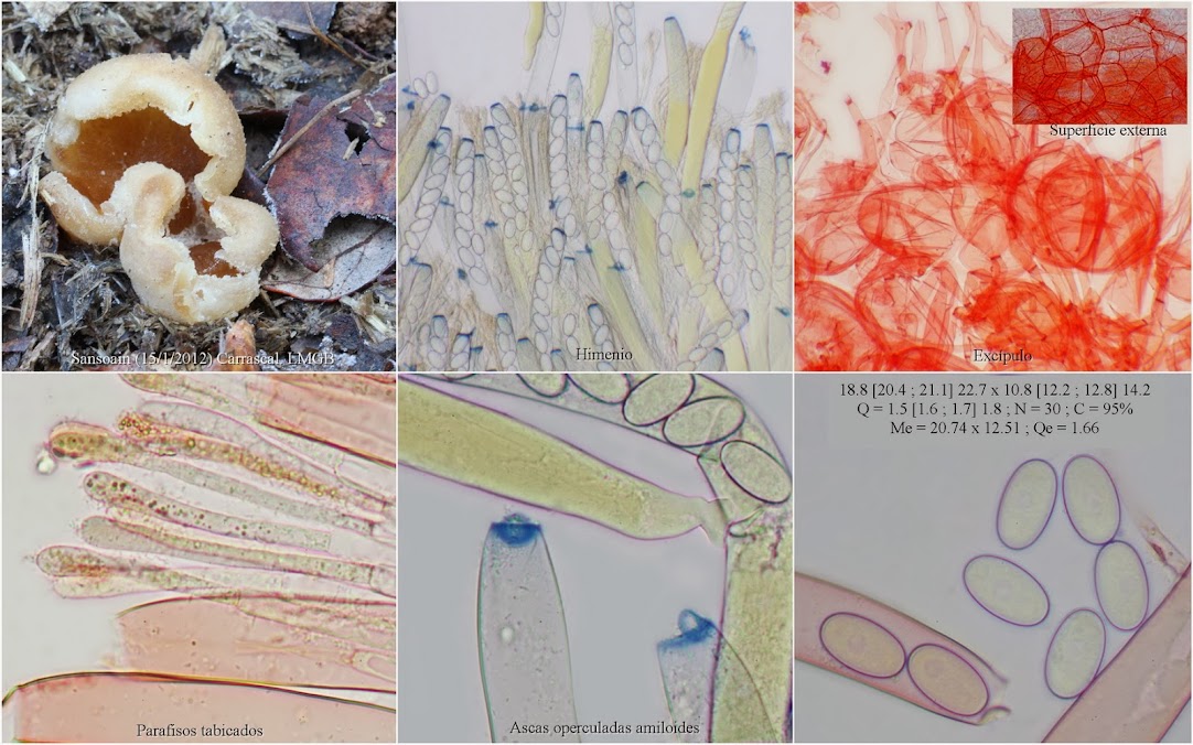 Microscopía de hongos. Vol 4. O - R: Peziza vesiculosa