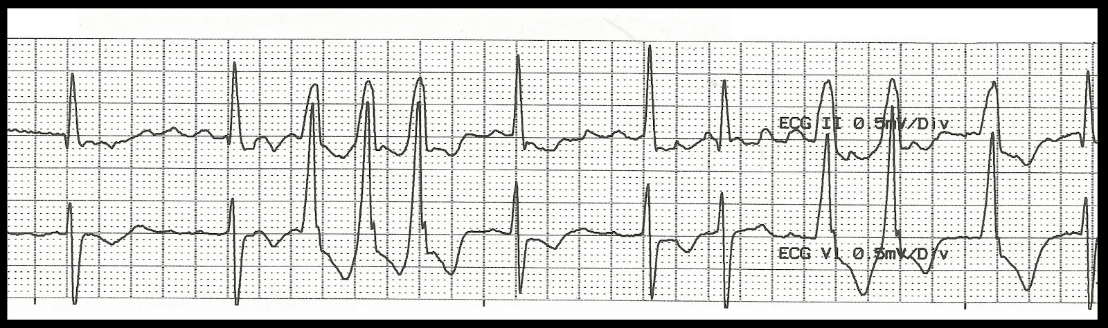 Practice EKG Rhythm Strips 184