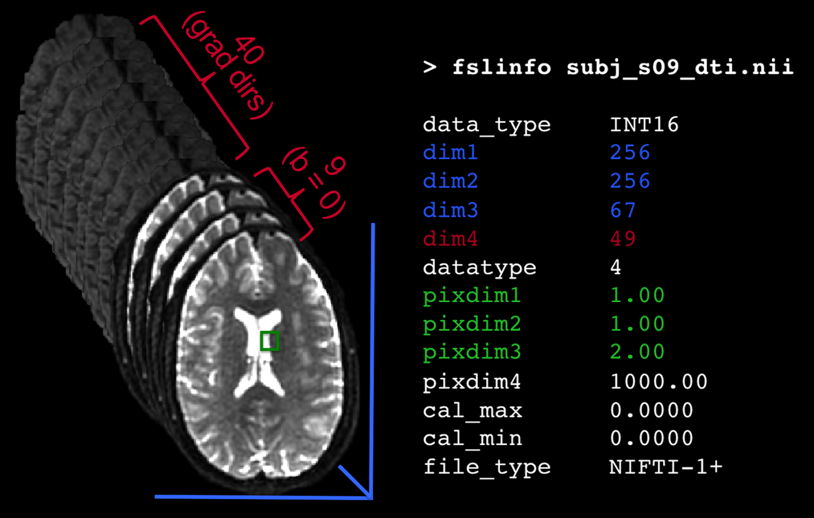 DTI Quality Control - Part 1: Acquisition | Diffusion Imaging; Introduction, tutorials and ...