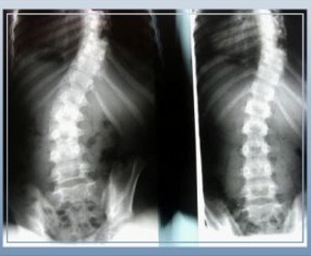 Pic microcontrollers programming in c milan verle pdf - saverlasopa