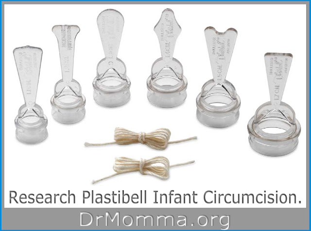 peaceful parenting: The Perils of Plastibell Circumcision: A Mythical ...