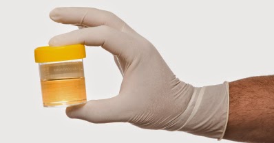 Penyebab Urin Berbusa