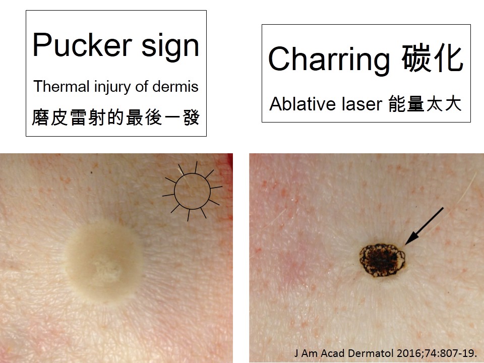 台中皮膚科推薦 | 蔡逸群醫師: 10月 2017