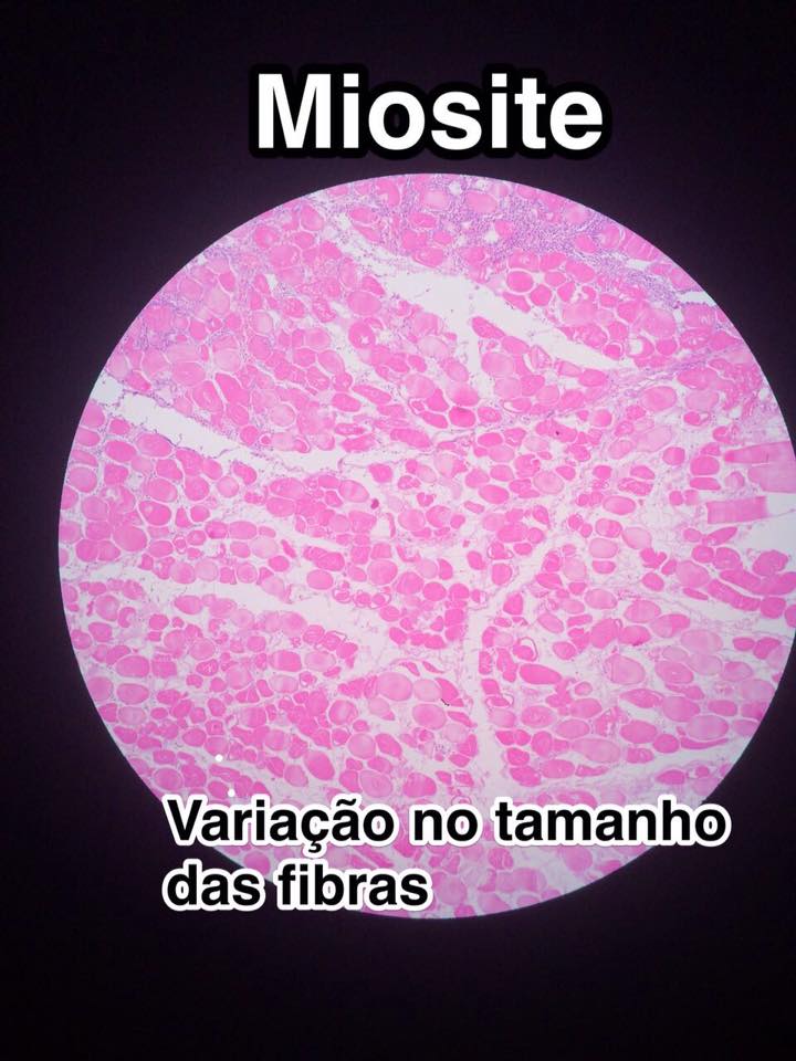 HISTOLOGIA90: MIOSITE