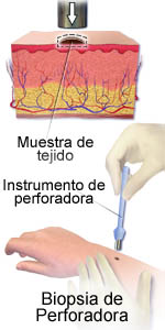 FILARIAS: *FILARIAS*