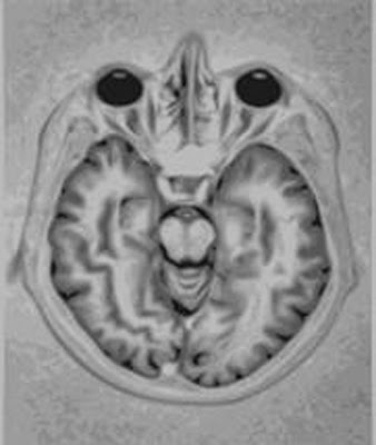 Pengertian MRI (Magnetik Resonance Imaging) - Lab Wisnu