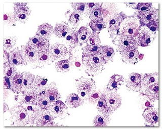 Biologi XI IPA: SISTEM TRANSPORTASI