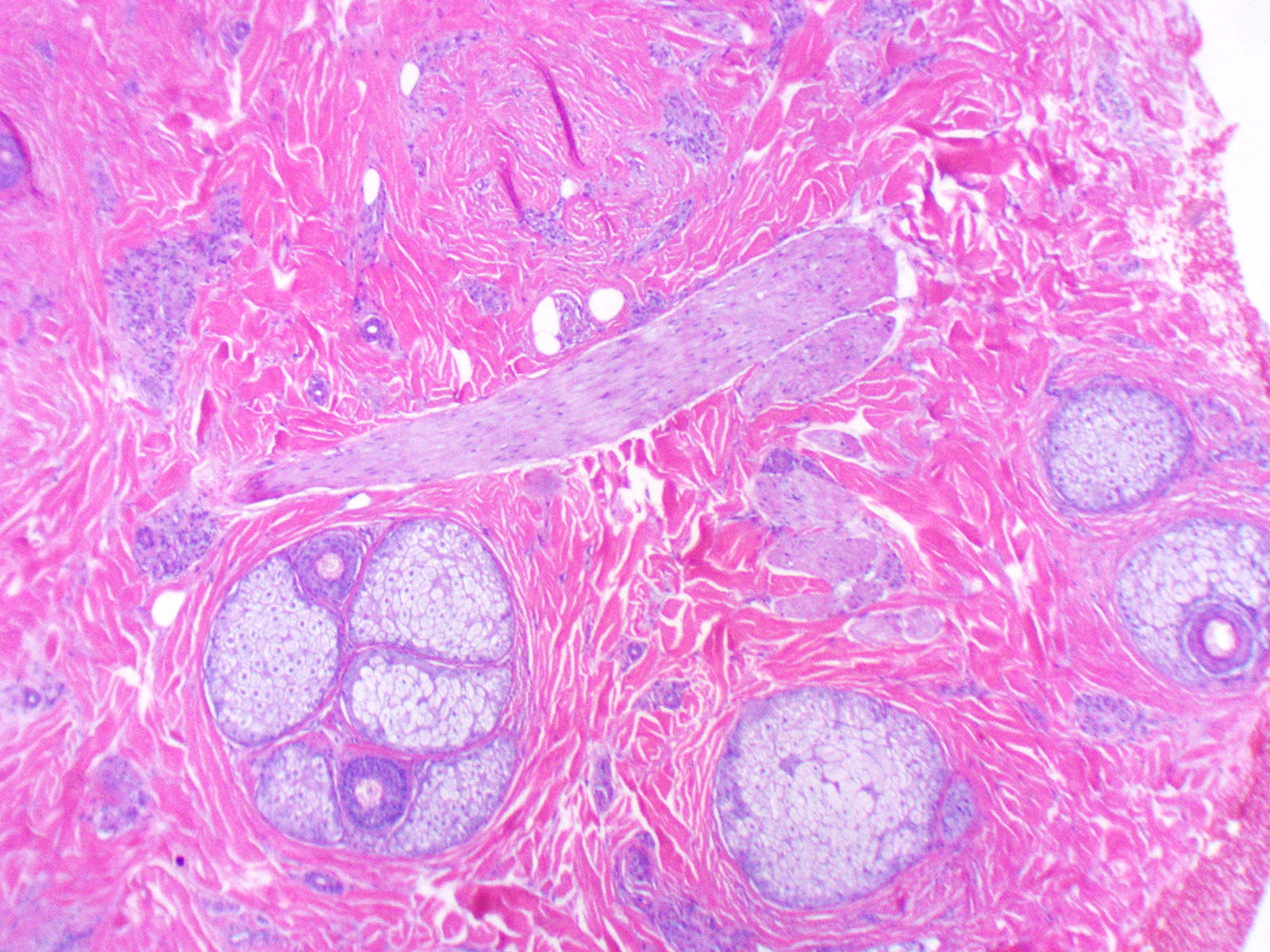 VIRTUAL GRAND ROUNDS IN DERMATOLOGY 2.0: Central Centrifugal ...