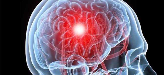 Primeros Auxilios: shock