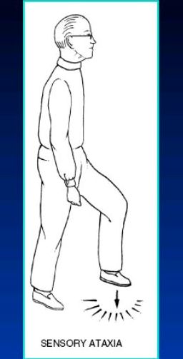 Ataxic Gait