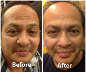 Testimoni Firmax3 Cream - Toko Firmax3 Indonesia