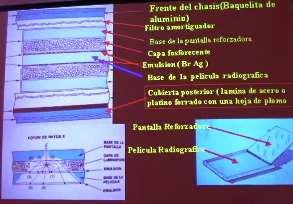 RADIOANATOMIA: PRIMERA CLASE DE RADIOANATOMIA