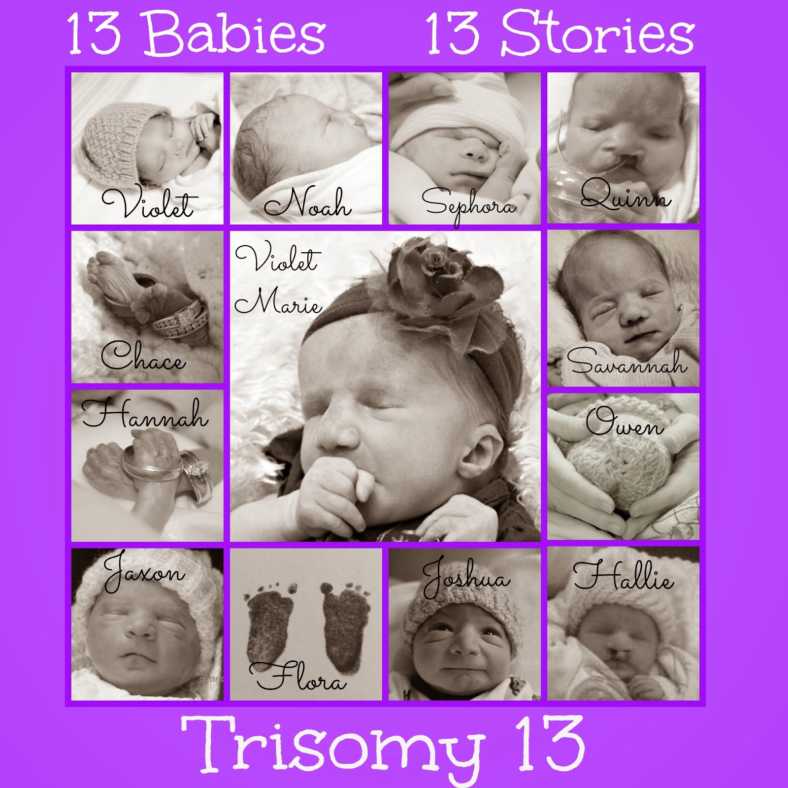 Trisomy 13 And 18 Treatment Decisions In A Stable Gray Zone Bioethics