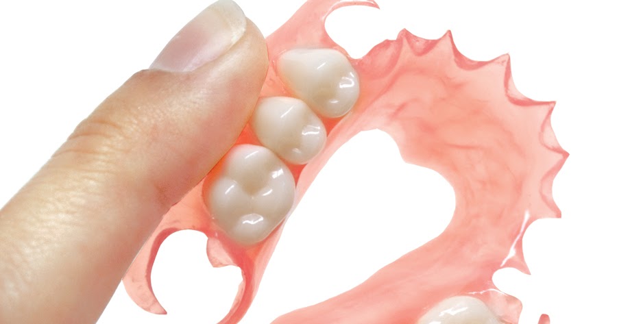 VALPLAST- Que es? y como se hace? | Odontología al Dia