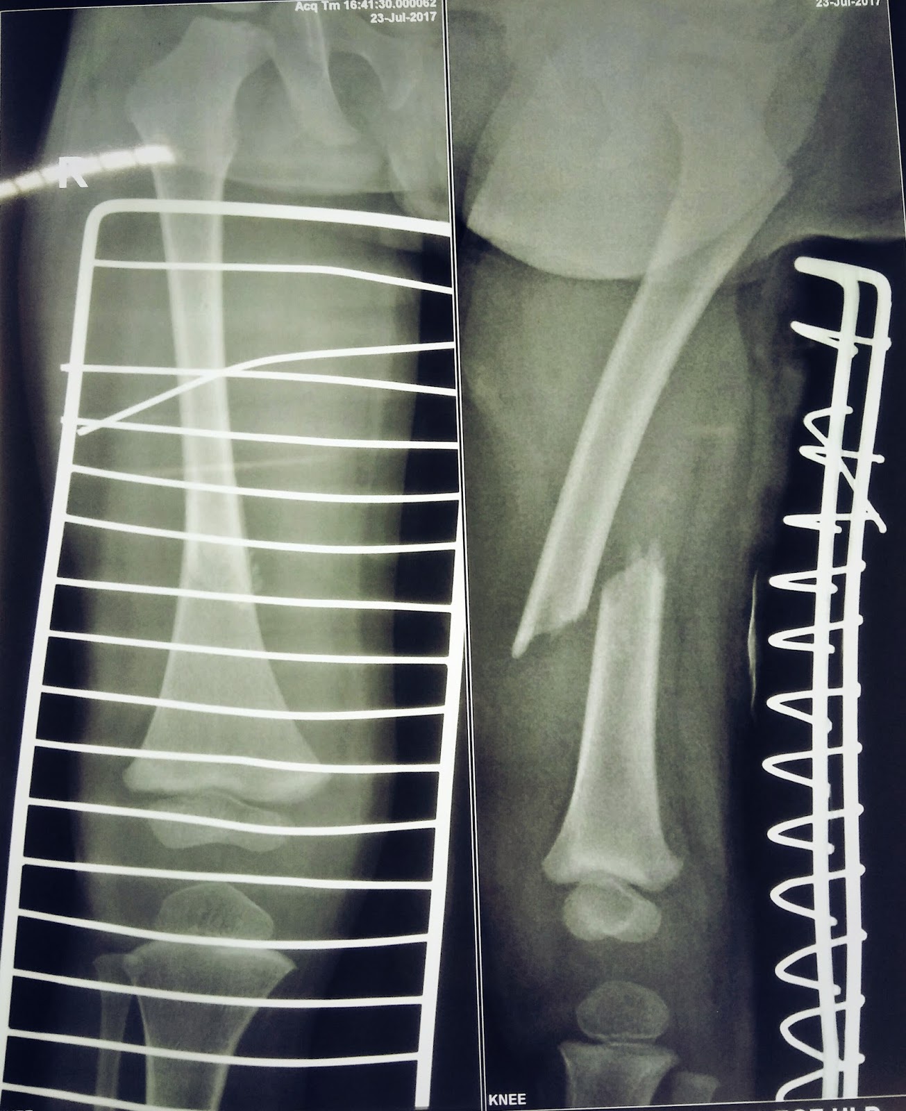 Ortho Image MCQs (Undergraduate level): 2017