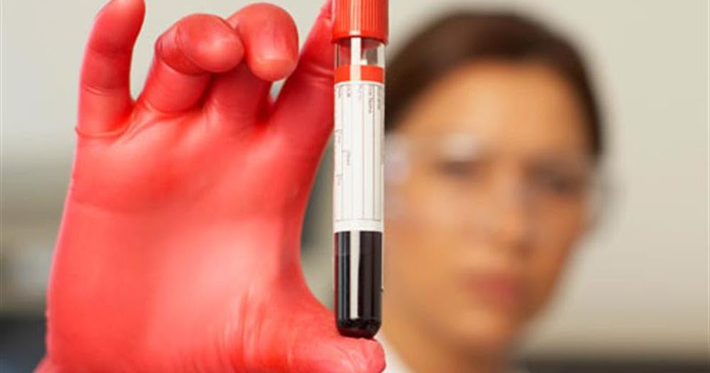 Medical Laboratory and Biomedical Science: New Blood Test for Active ...