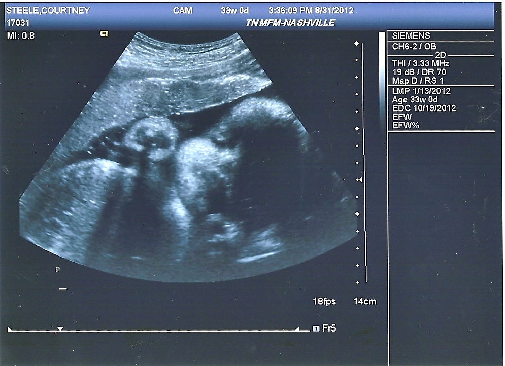 The Steeles: Baby Weeks 31-33