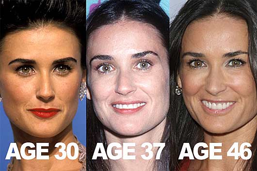 Demi Moore Plastic Surgery Before and After Nose Job and Botox - Star ...