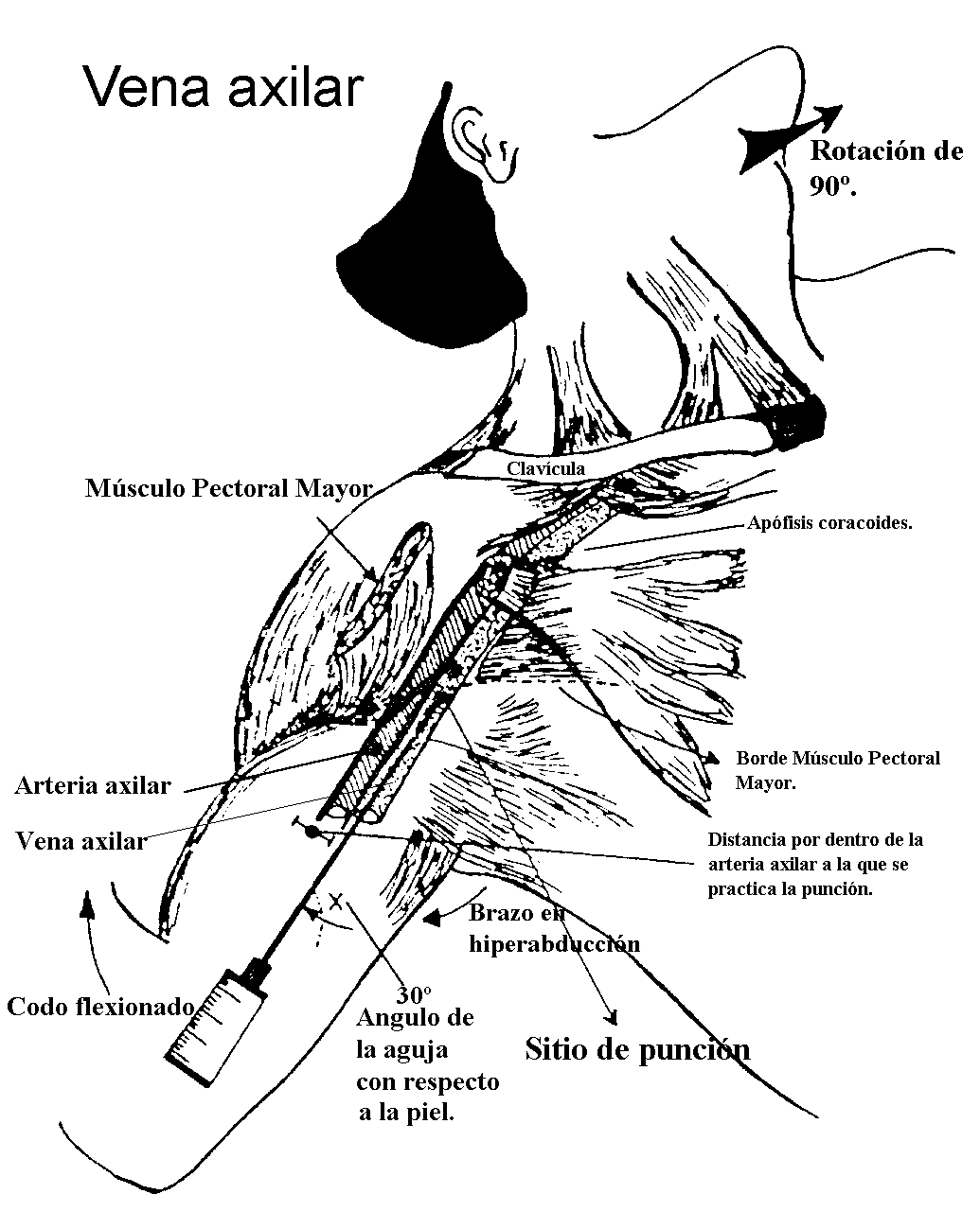 Canalización de vías venosas